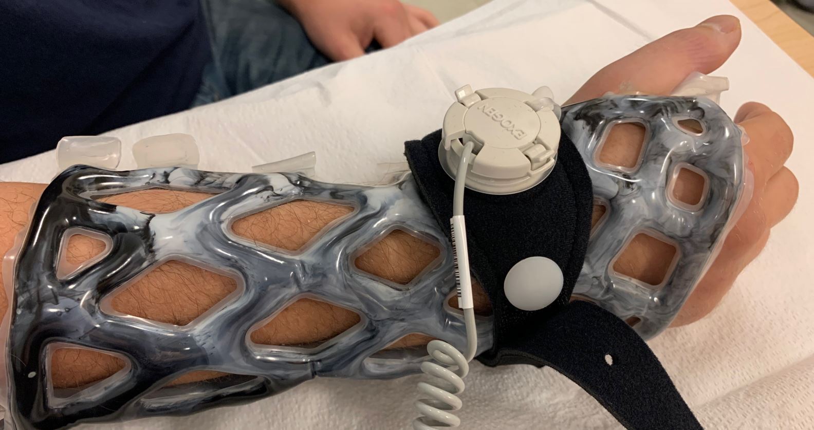 What Is A Bone Growth Stimulator And How Does It Work 
